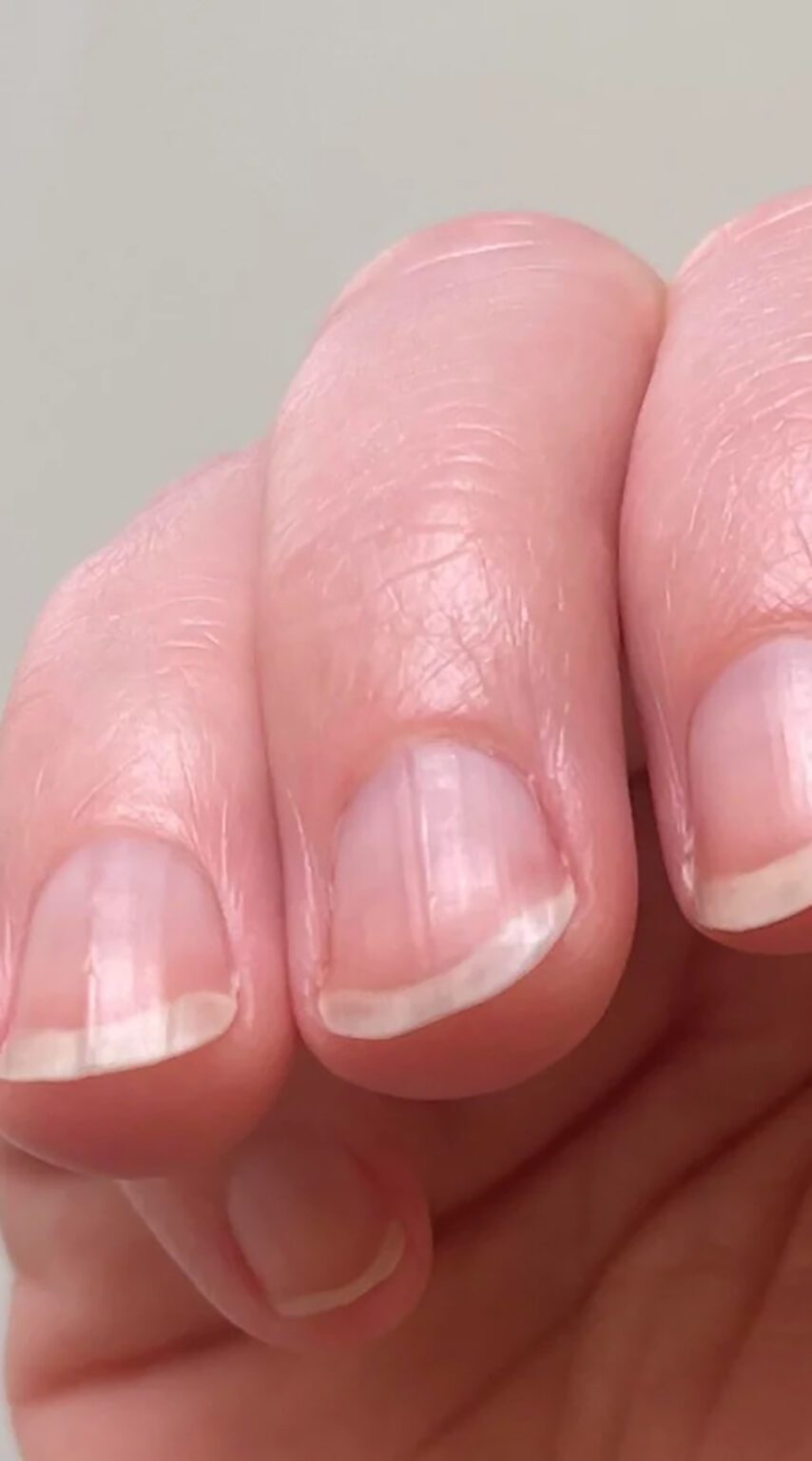 How to Finally Get Rid of Ridges on Fingernails: Simple Tweaks for ...