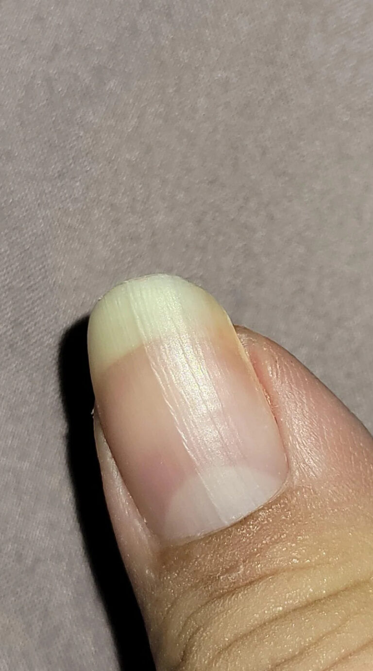 How to Finally Get Rid of Ridges on Fingernails: Simple Tweaks for ...